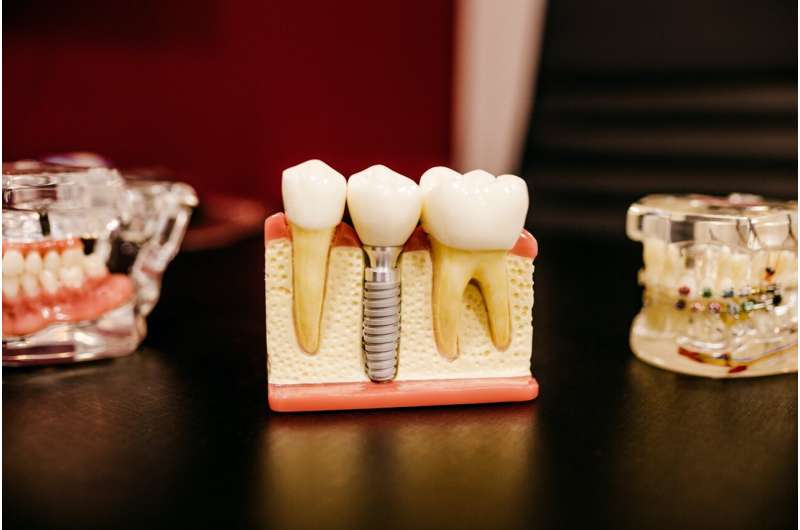 “Bone Grafting in Dentistry: A Simple Guide for Improved Dental Health ...